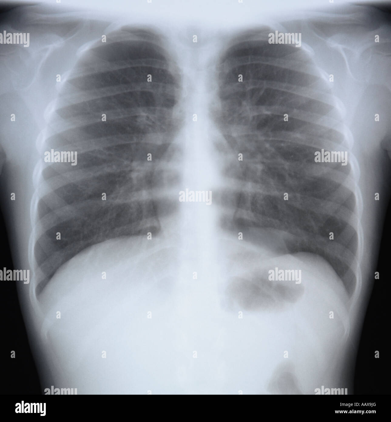 Chest bones hi-res stock photography and images - Alamy