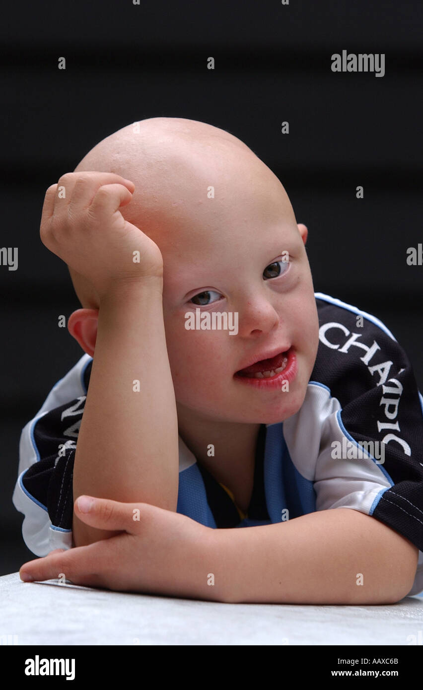 Cute child with Down s Syndrome portrait down syndrome Stock Photo - Alamy