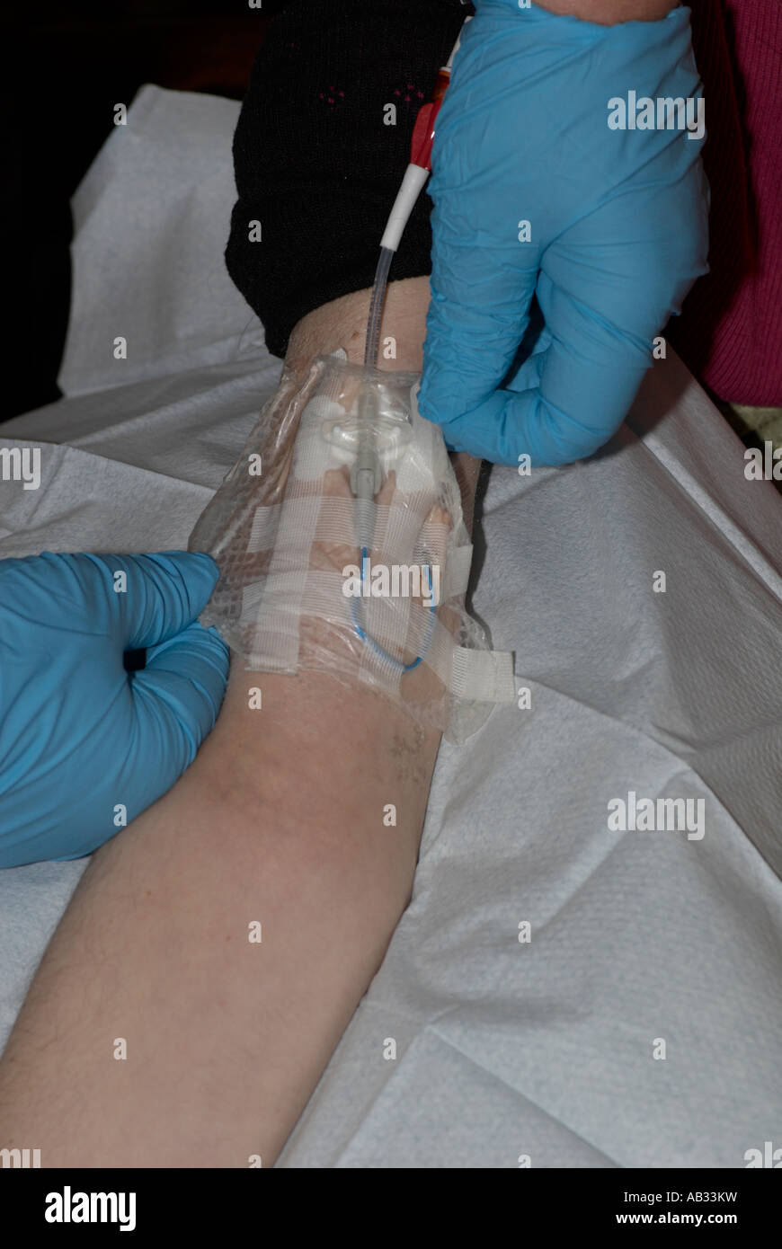 Picc line cancer hi-res stock photography and images - Alamy