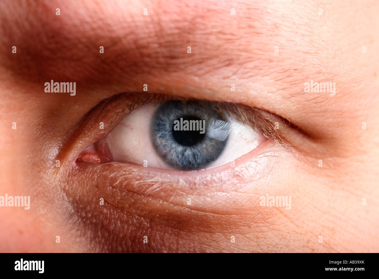 Disfigured man face hi-res stock photography and images - Alamy