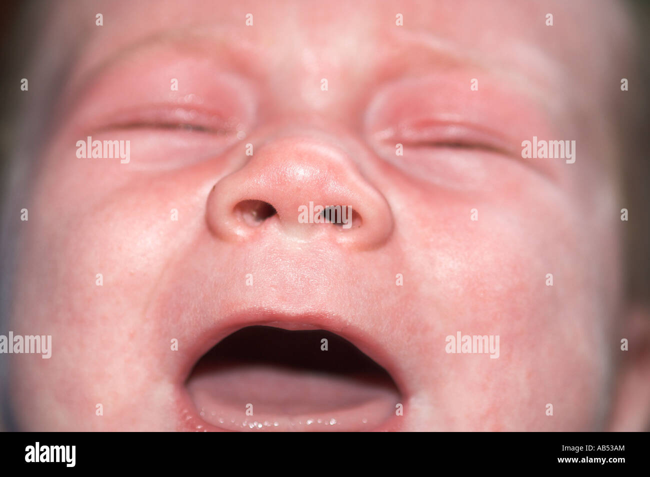 Agitated baby hi-res stock photography and images - Alamy