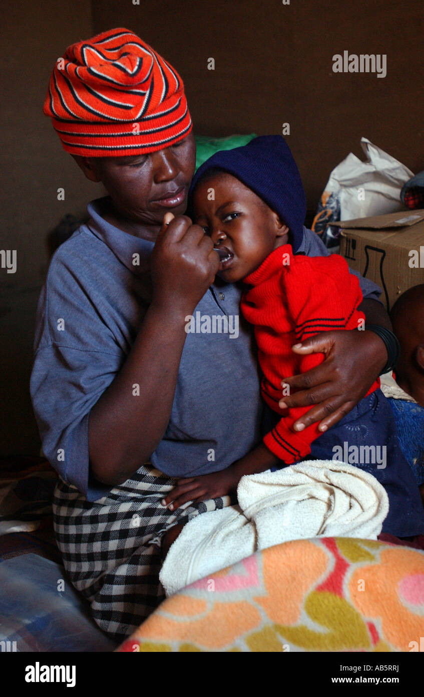 Malnourished child africa hi-res stock photography and images - Alamy