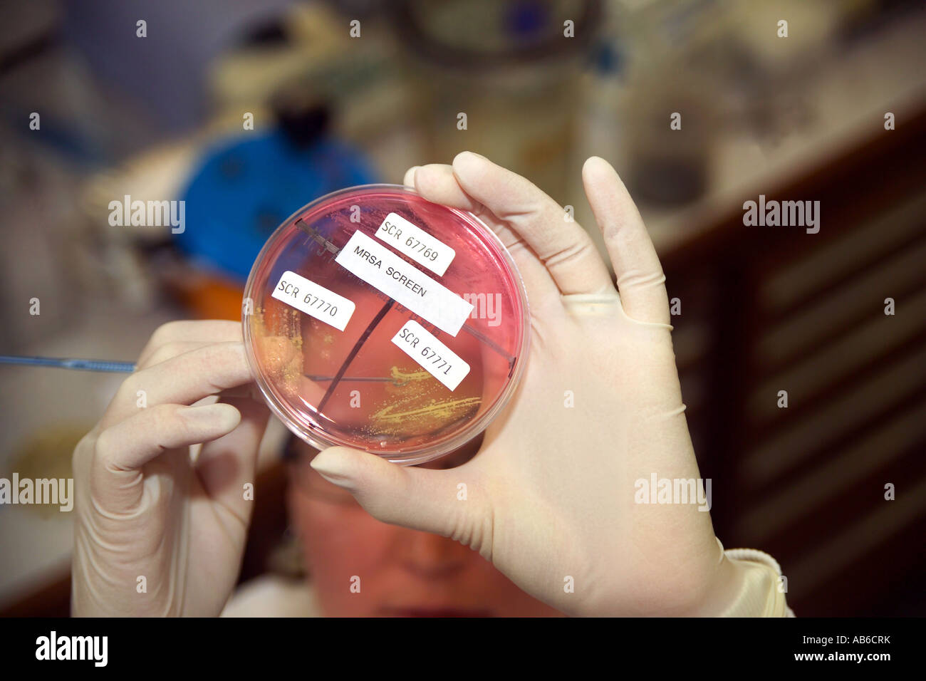 Cephalosporins hi-res stock photography and images - Alamy