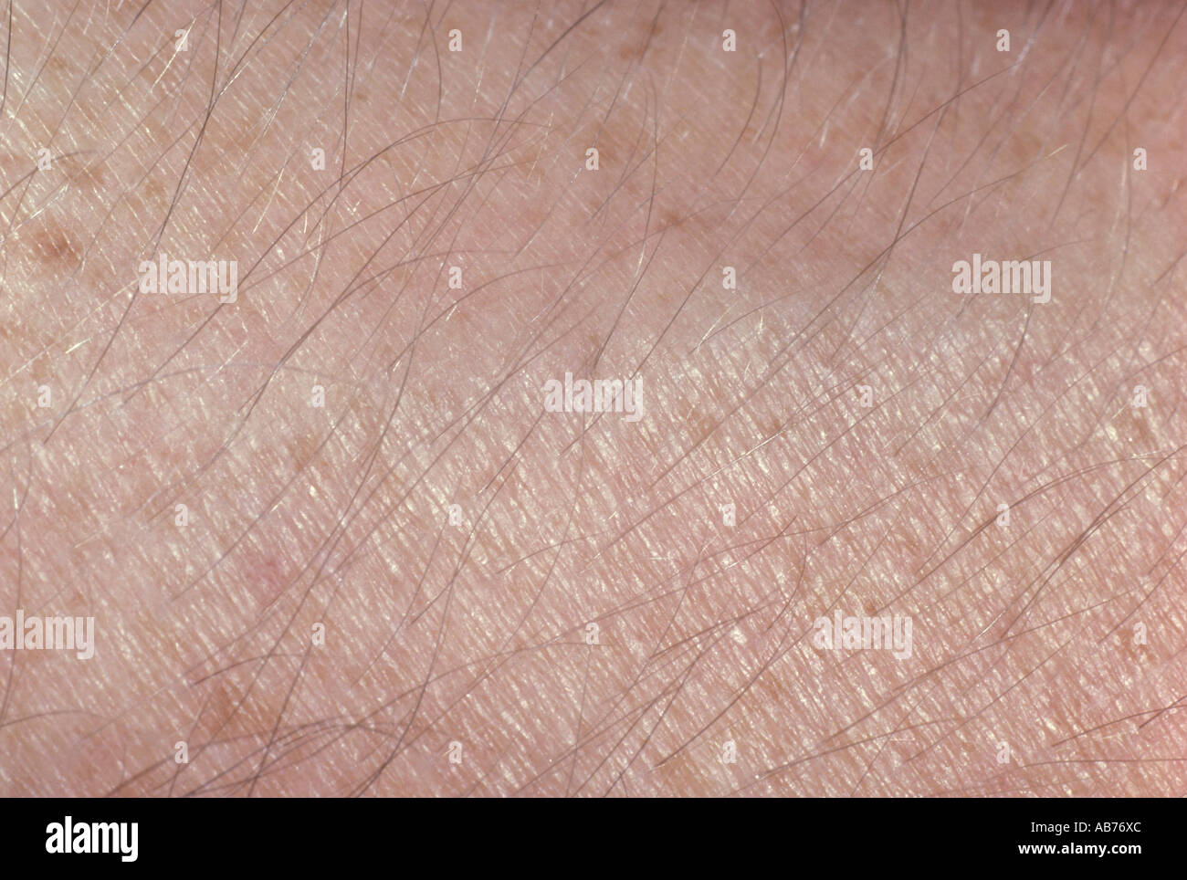 Anatomy Human Skin Skin Stock Photo - Alamy