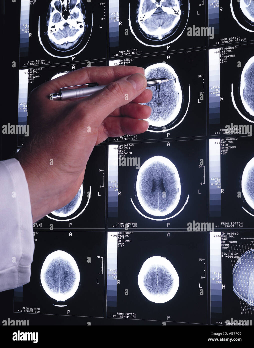 Brain scans hi-res stock photography and images - Alamy