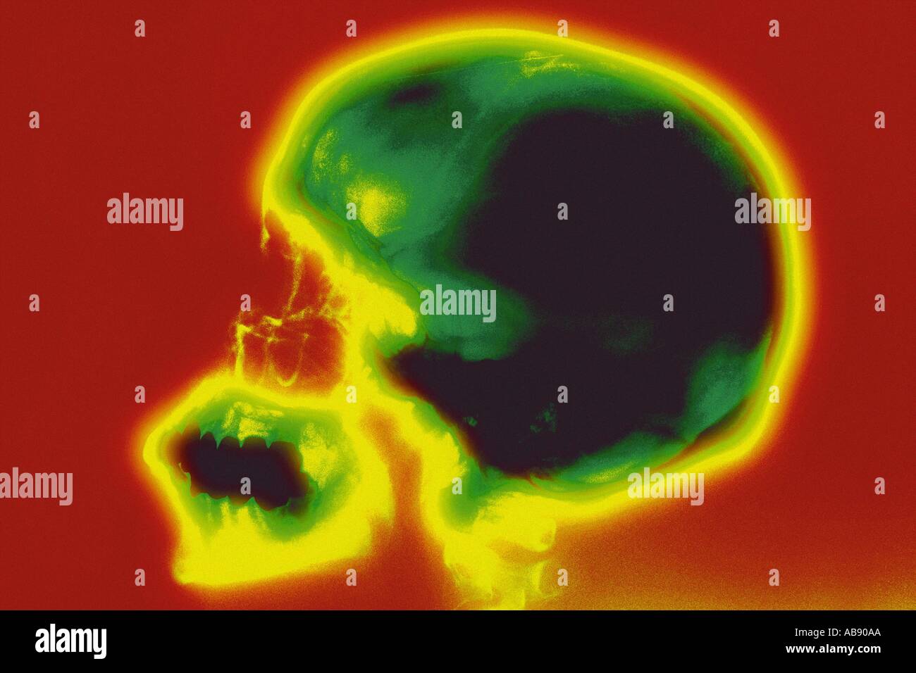 Brain imaging color hi-res stock photography and images - Alamy