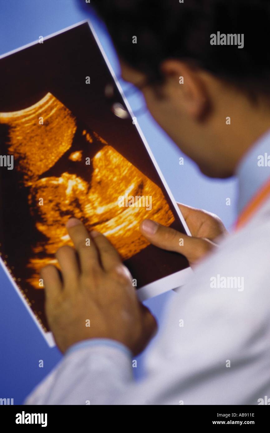 Doctor checking scan Stock Photo - Alamy