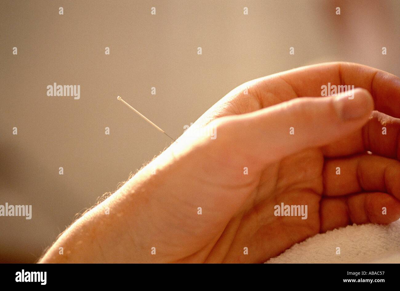 Hand care acupuncture hi-res stock photography and images - Alamy