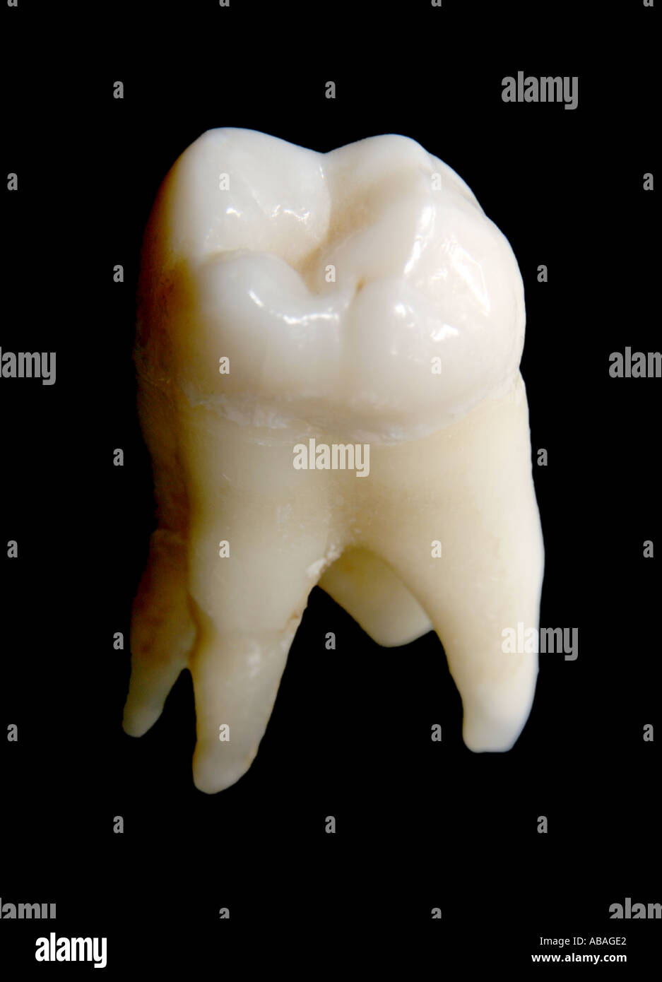 Tooth Pulled High Resolution Stock Photography and Images - Alamy