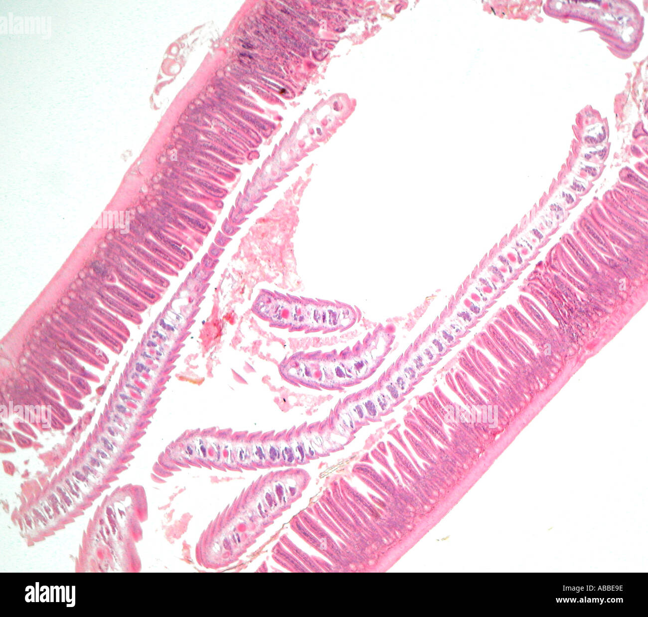 Tapeworm microscope hi-res stock photography and images - Alamy