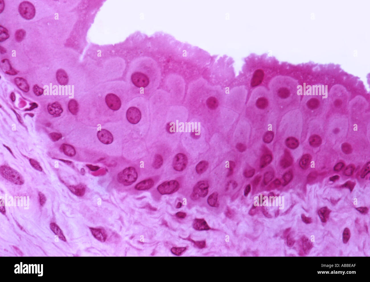 Transitional Epithelium Tissue