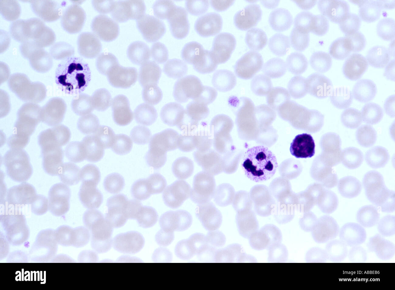 Human peripheral blood smear Low power Stained Brightfield Stock Photo ...