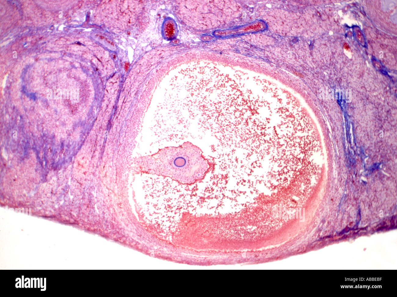 Ovary Slide Labeled Graafian Follicle