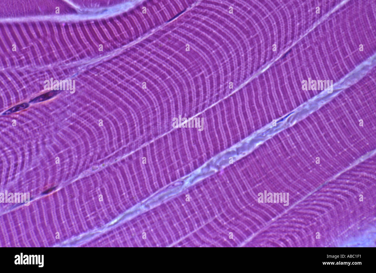 Striated muscle hi-res stock photography and images - Alamy