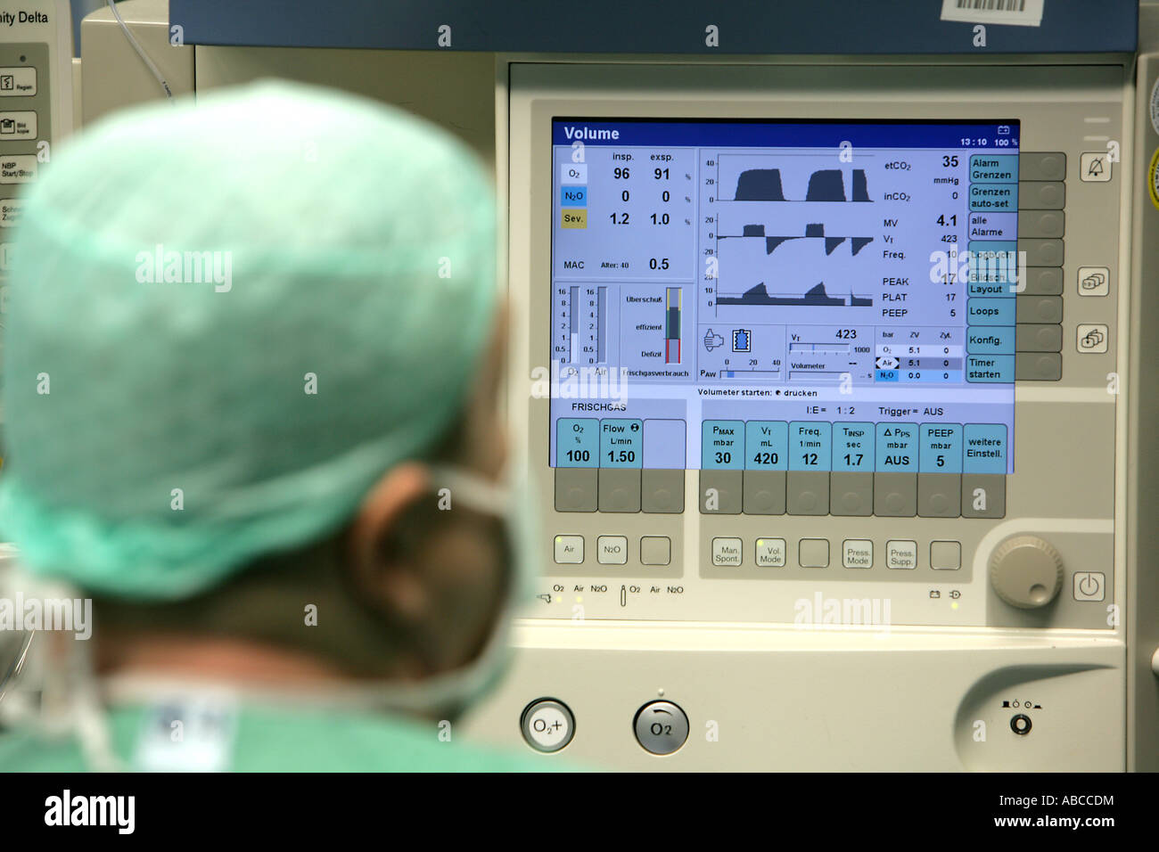 DEU Germany Patient during a surgery artificial respiration Monitoring ...