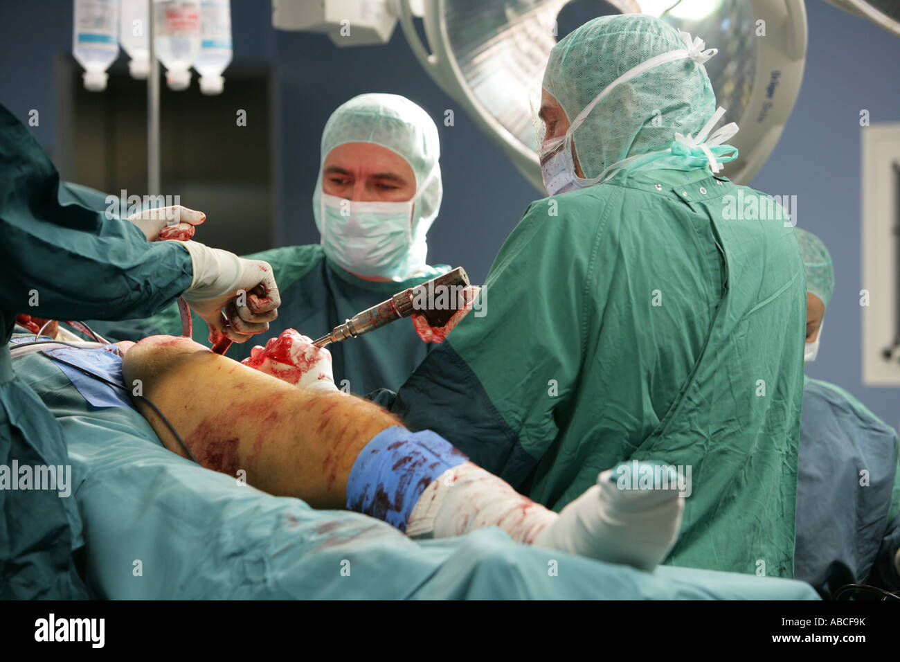 Artificial Hip Joint High Resolution Stock Photography and Images - Alamy
