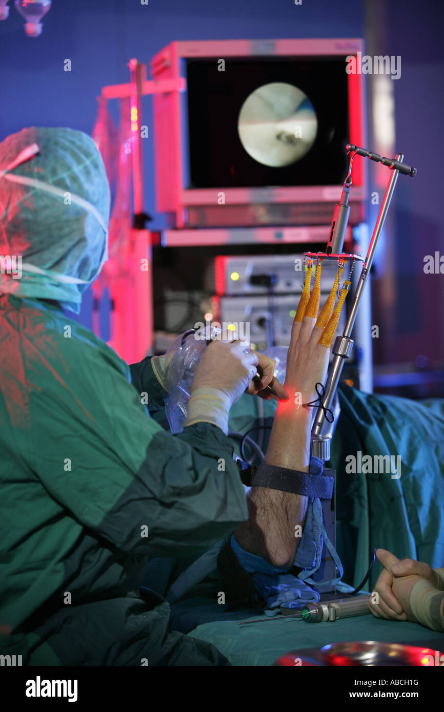 Arthroscopical hi-res stock photography and images - Alamy