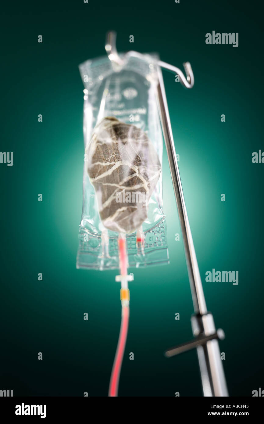 Blood bag stand hi-res stock photography and images - Alamy