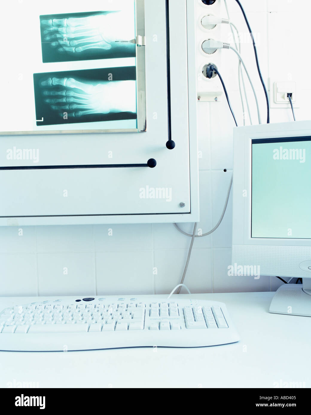 X-rays and computer Stock Photo - Alamy