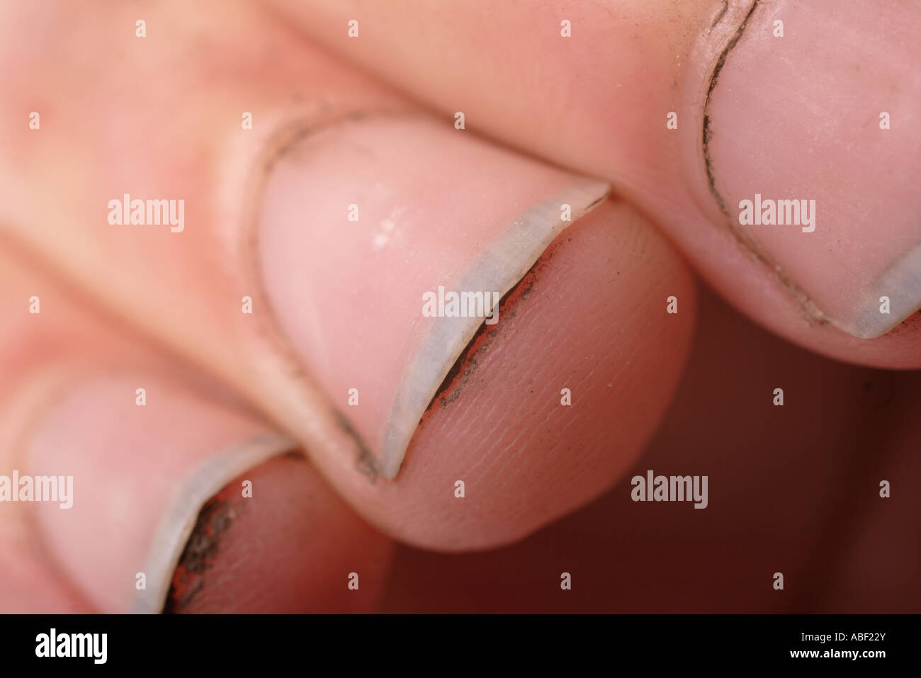 Unkempt nail hi-res stock photography and images - Alamy