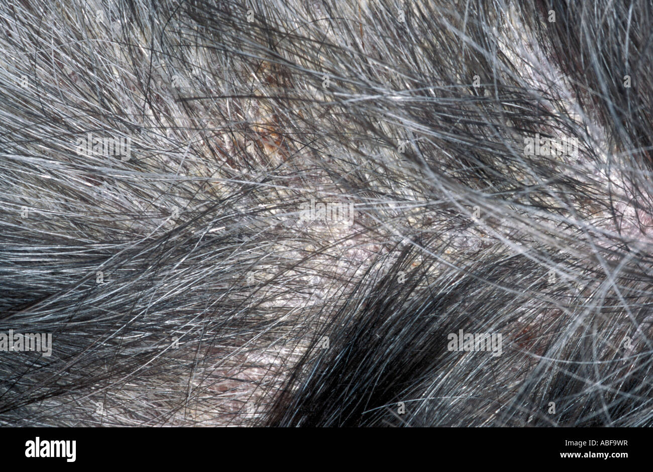 Face Inflammation Lyme