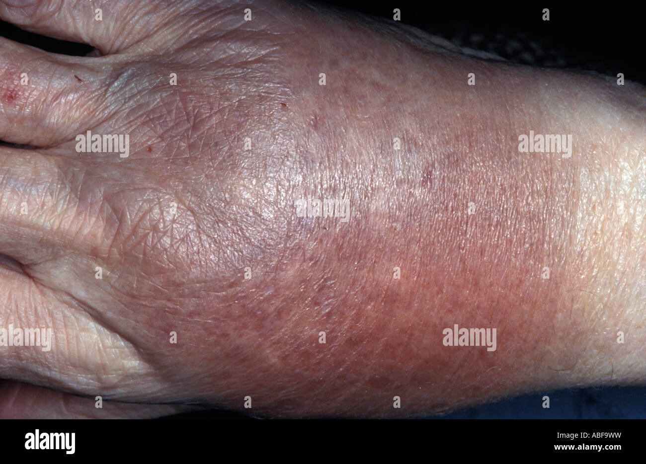 Fall Risk Elderly High Resolution Stock Photography and Images - Alamy