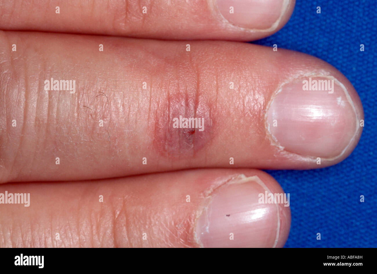 Orf sheep hi-res stock photography and images - Alamy