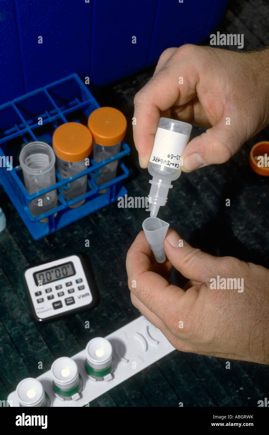 Small test kit hi-res stock photography and images - Alamy