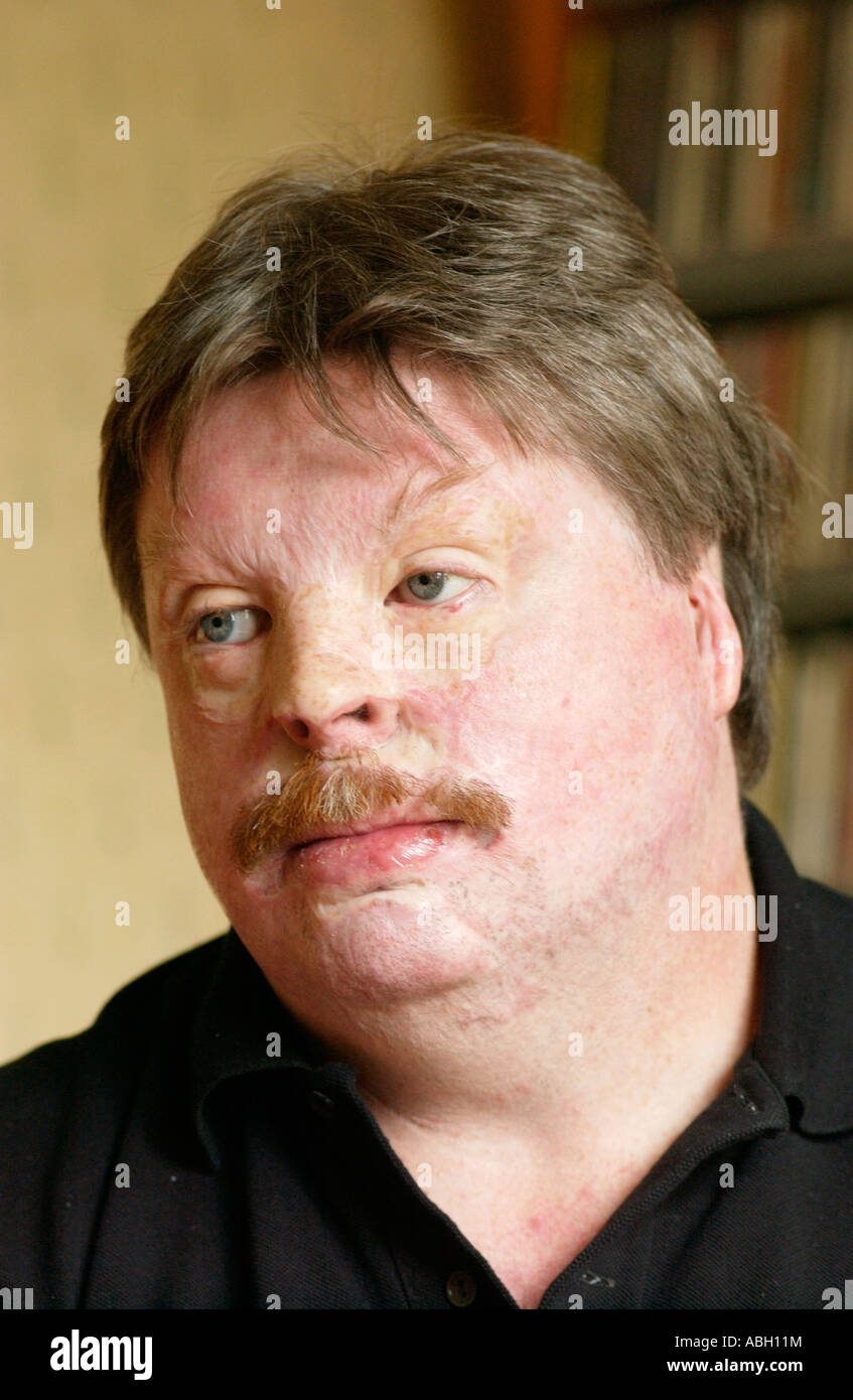 Simon weston hi-res stock photography and images - Alamy