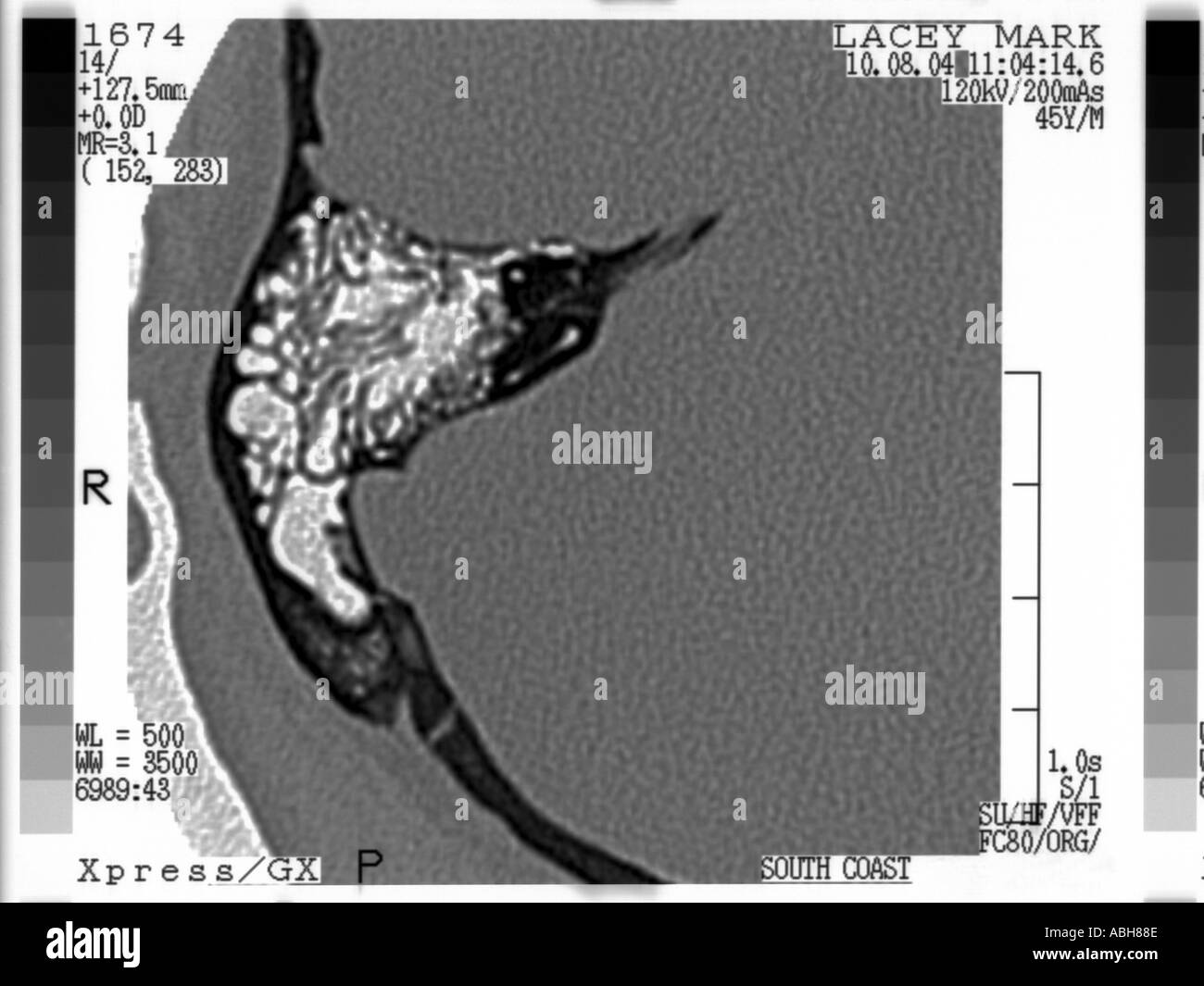 Cross section through brain hi-res stock photography and images - Alamy