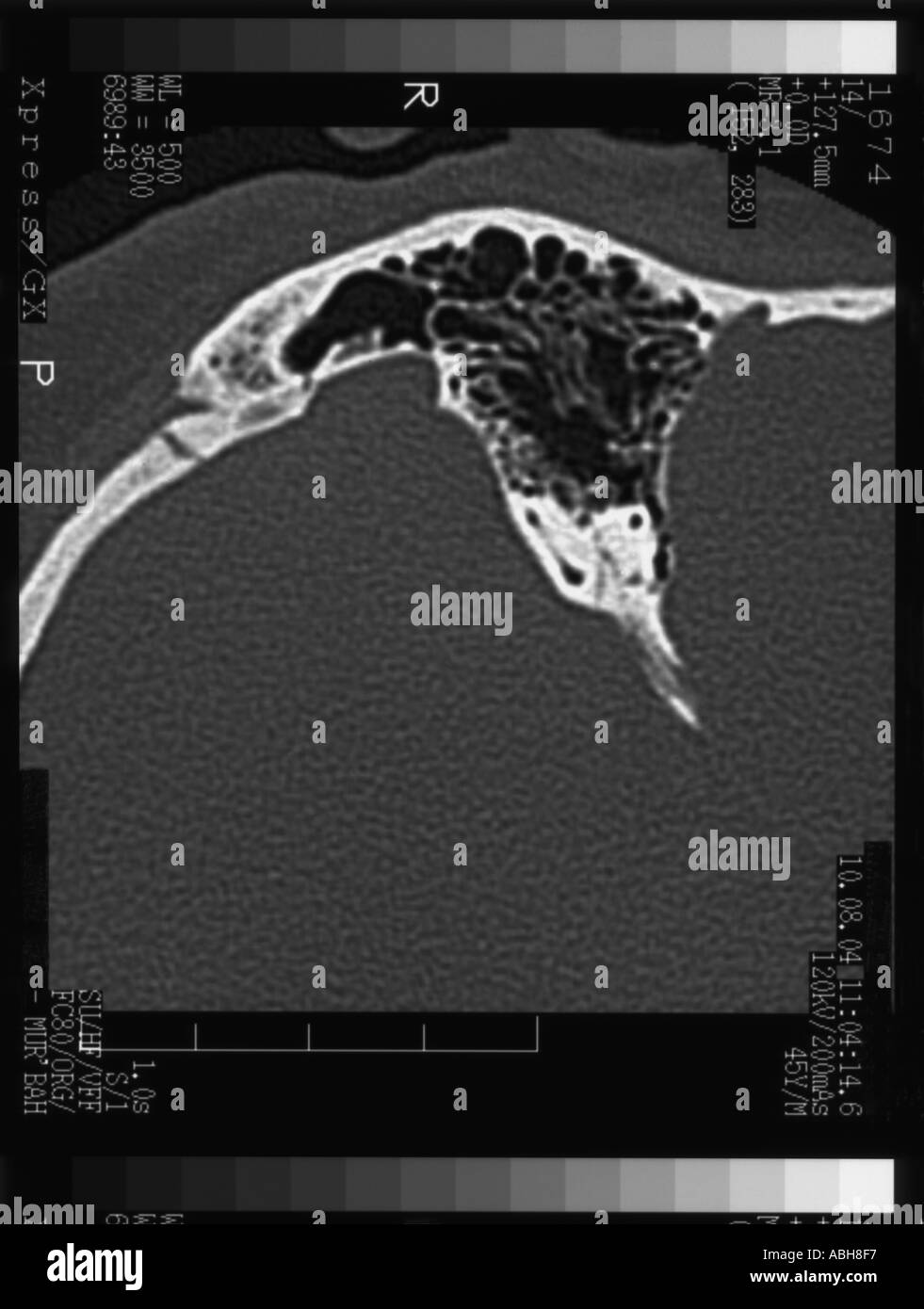 MRI Scan of the human skull showing the inner ear and brain Stock Photo ...