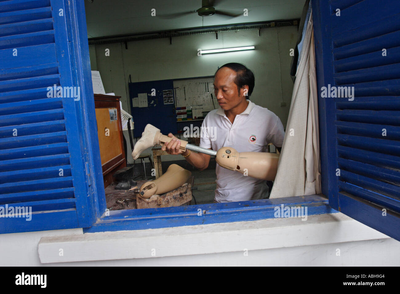 Technician in process of making a prosthetic leg at the Cooperative ...