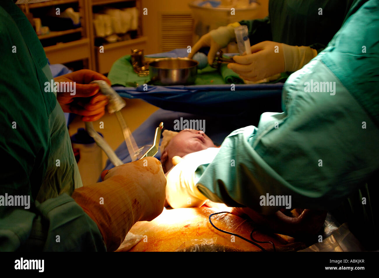 Birth of baby boy by caesarian section Stock Photo - Alamy