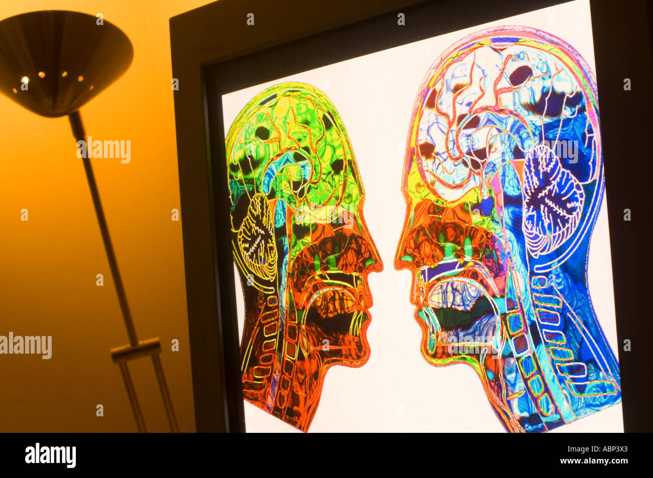 colorful x-rays of two human heads displayed on computer monitor for ...