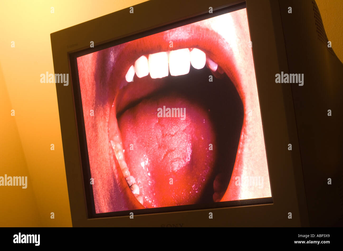 closeup of mouth displayed on computer monitor Stock Photo - Alamy