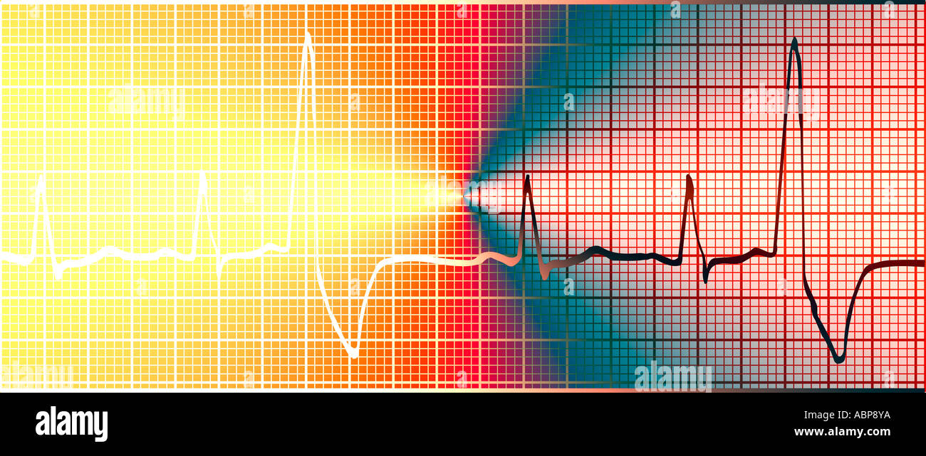 abstract view of EKG electrocardiogram concept Stock Photo - Alamy