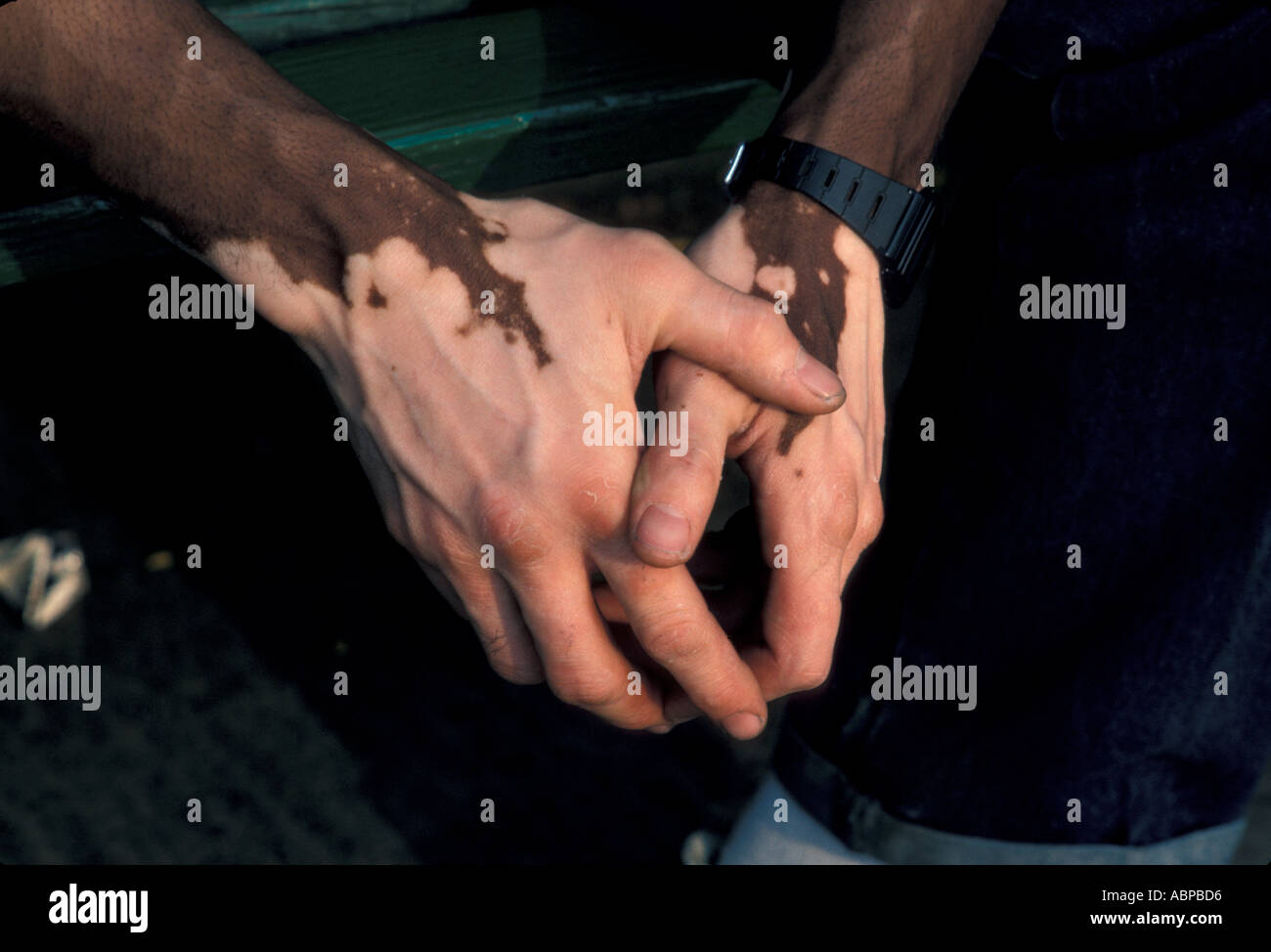 SCIENCE MEDICAL Skin Stock Photo - Alamy
