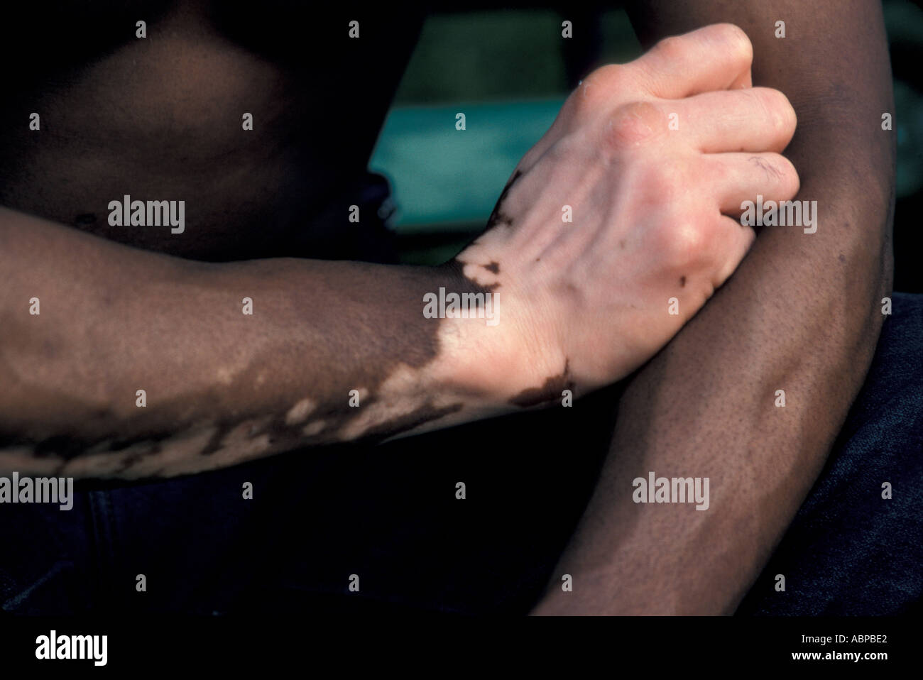 SCIENCE MEDICAL Skin Stock Photo - Alamy