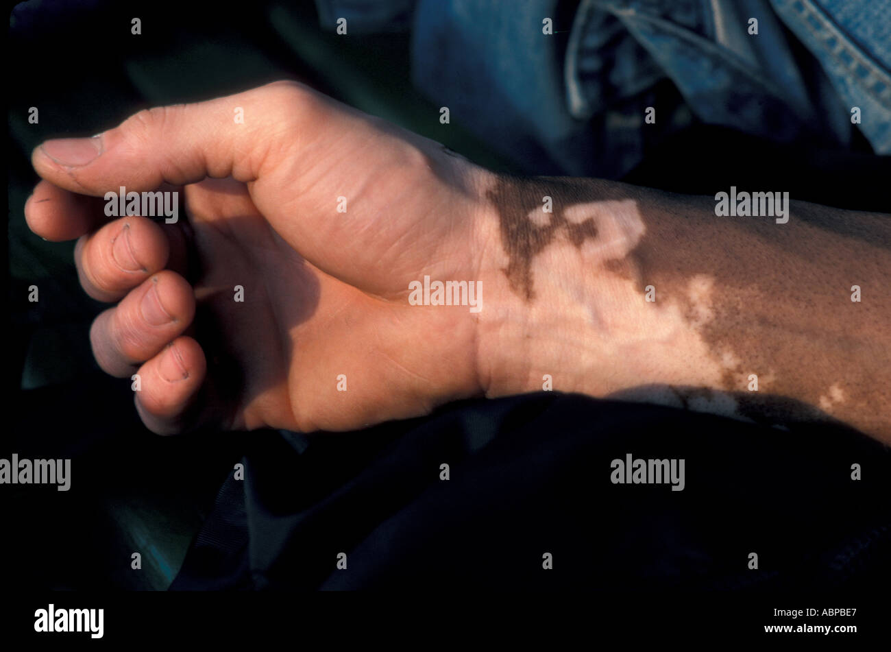 SCIENCE MEDICAL Skin Stock Photo - Alamy