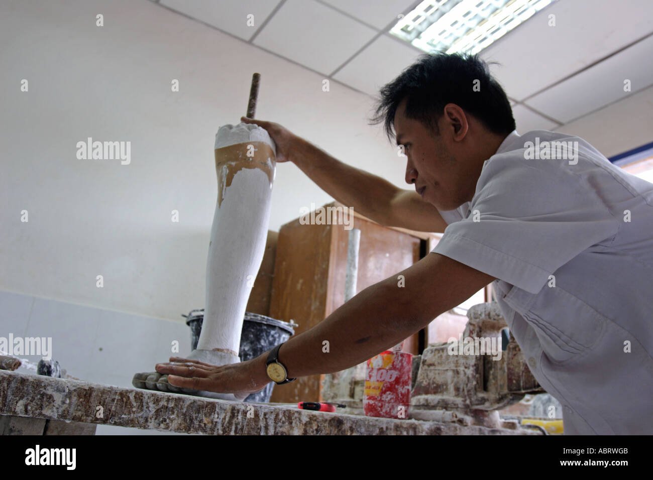 Technican in process of making a prosthetic leg at the Cooperative ...