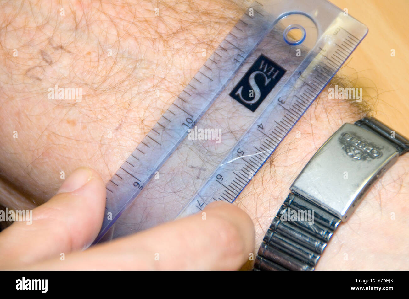 Performing Skin prick test for diagnosis of atopy and allergy Stock ...