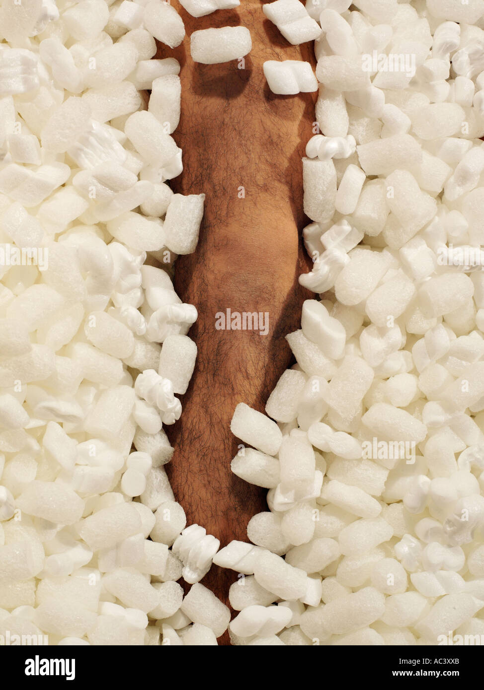 Leg transplant hi-res stock photography and images - Alamy