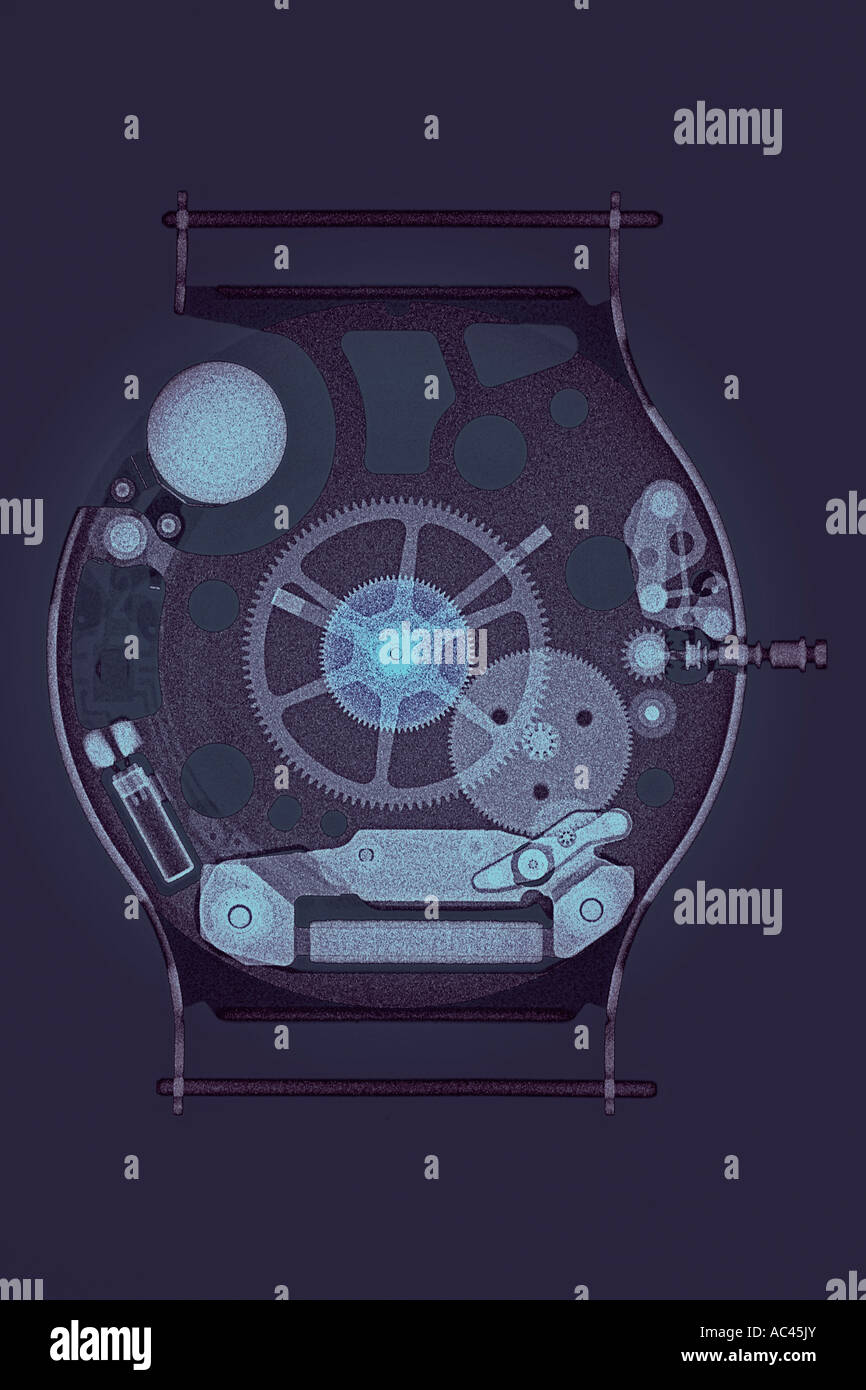 An X-ray photograph of a watch in a plastic watch-case. Radiographie d ...