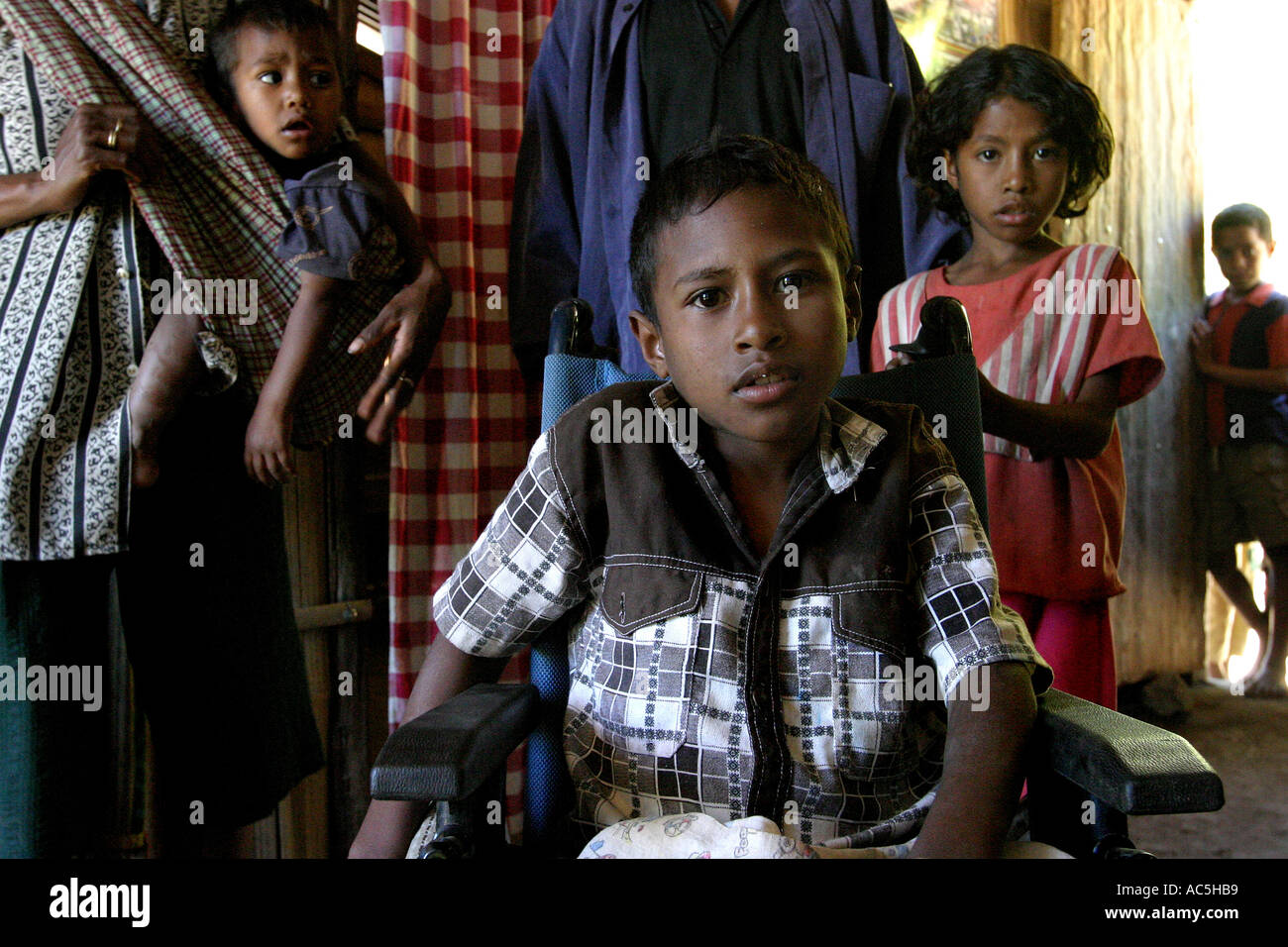 East Timor Young boy marco sits in a wheelchair given to him by an NGO ...