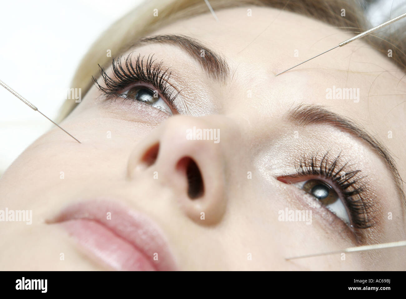 Acupuncture needles in the face Stock Photo - Alamy