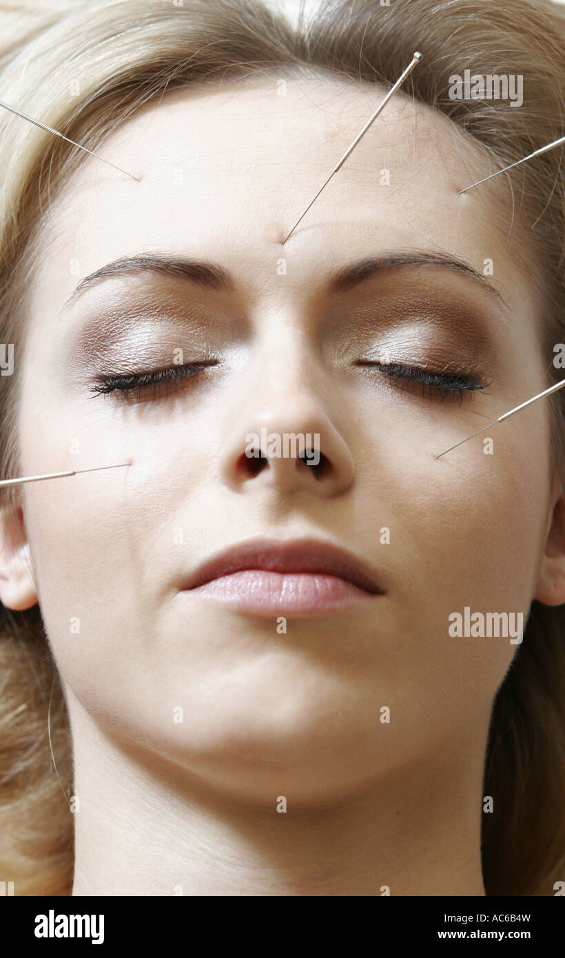 Acupuncture needles in the face Stock Photo - Alamy