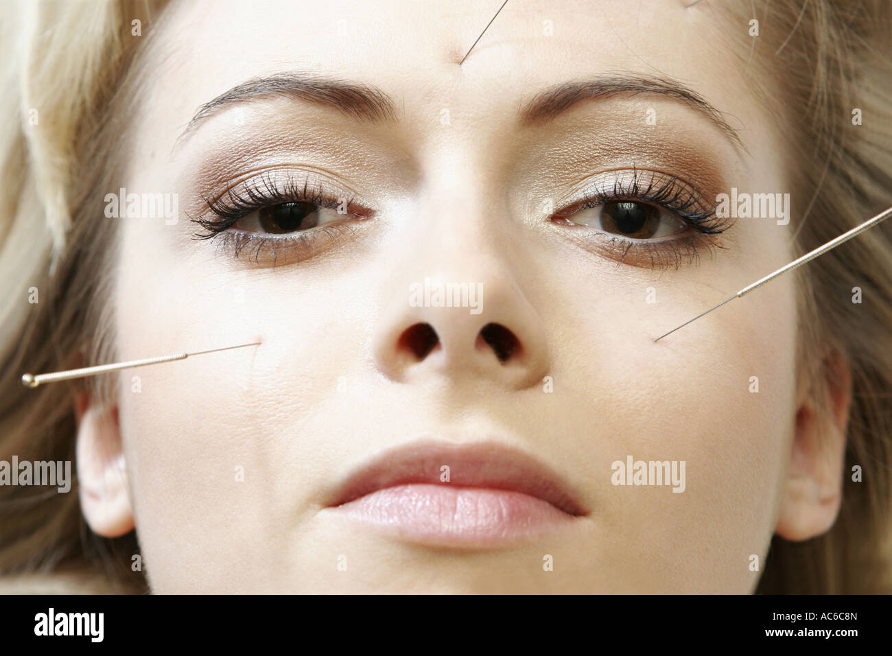 Acupuncture needles in the face Stock Photo - Alamy