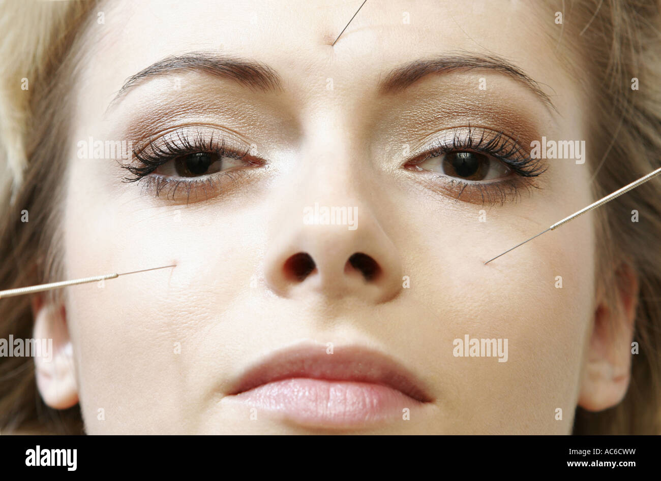 Open acupuncture hi-res stock photography and images - Alamy