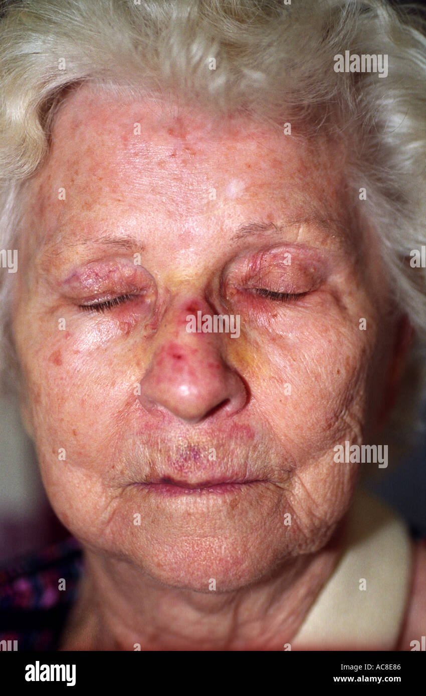 older woman with bruised face after fall in parking lot 1552 Stock ...