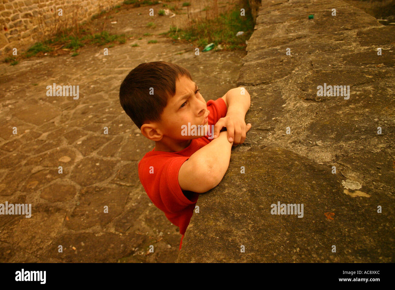 A young disabled gypsy child looking into the distance Stock Photo - Alamy